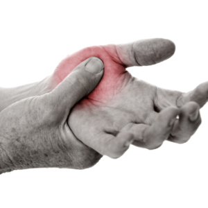 Guide To CRPS | Centurion Spine & Pain Centers